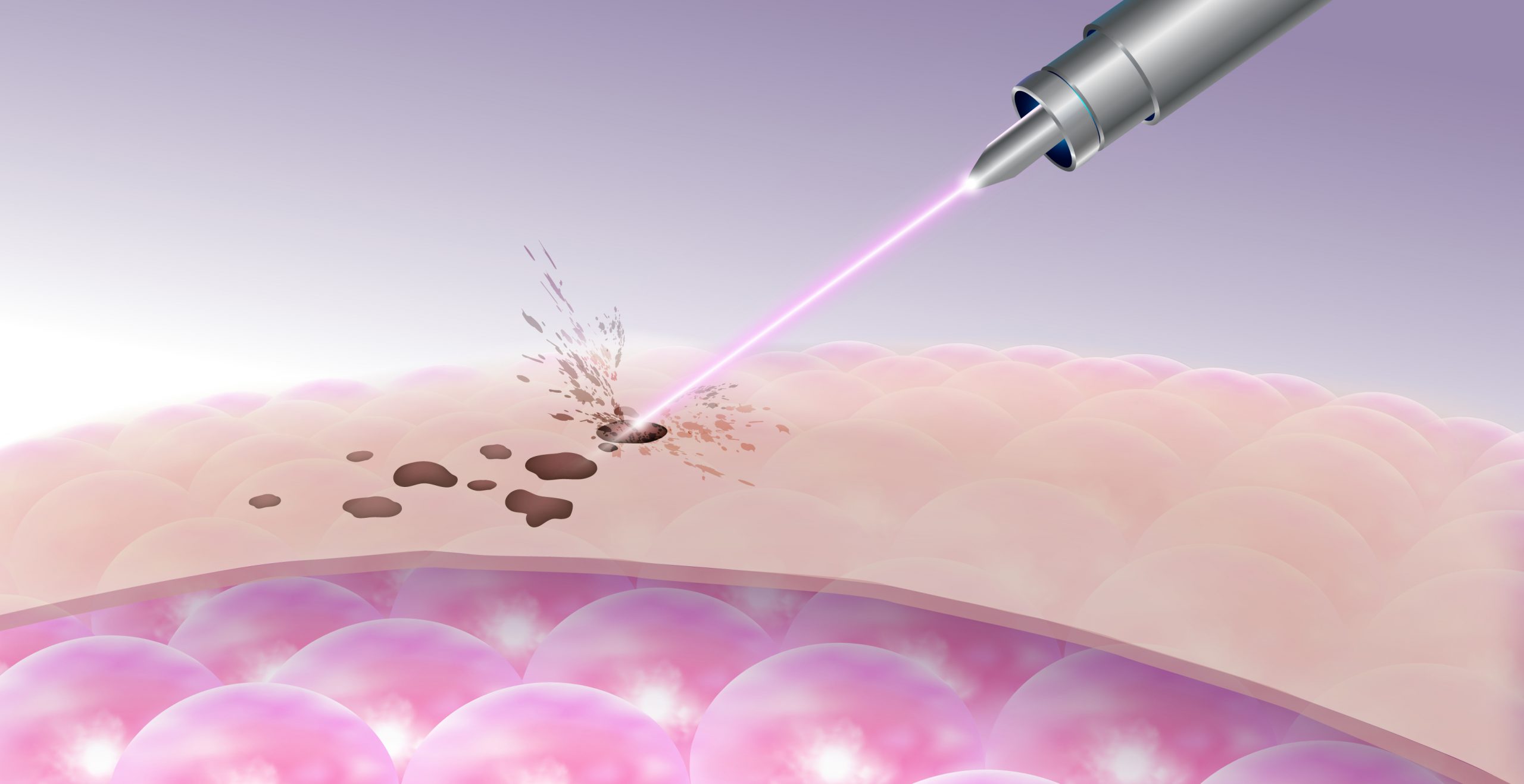 Scar Reduction / Skin Resurfacing - Dr Jon Yong Aesthetic Clinic